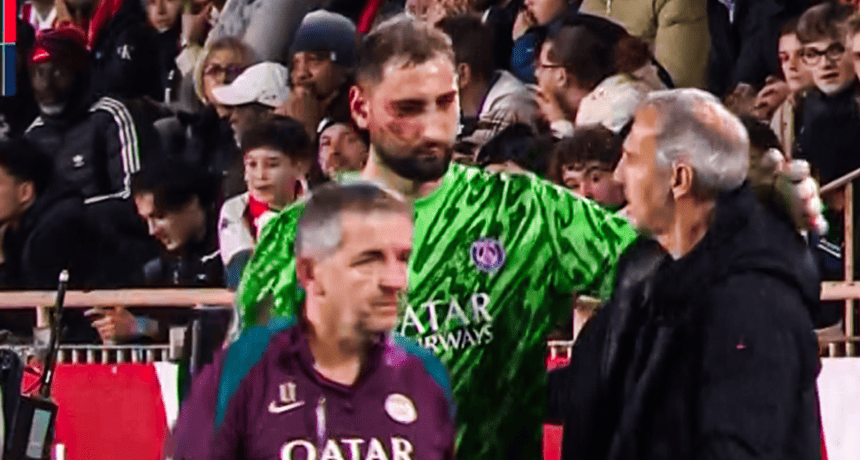 Horror: Gianluigi Donnarumma suffers gruesome head injury | Dailysports